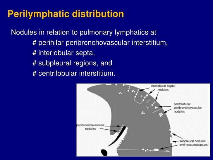 Technical aspect of hrct; normal lung anatomy & hrct findings of lung…