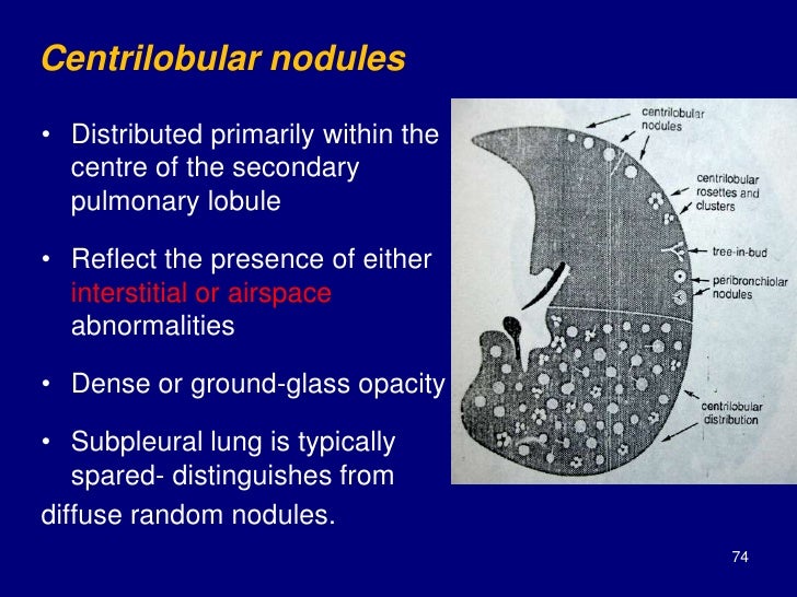 Technical aspect of hrct; normal lung anatomy & hrct findings of lung…