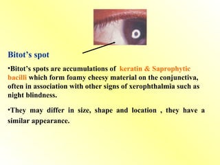 Technical Aspect of Vitamin A............ | PPT