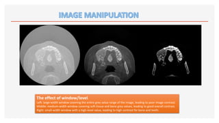 Technical aspects of dental CBCT - Dr. Kavan Gandhi | PPTX | Eye and ...