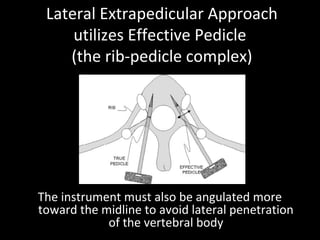 Technical aspects of percutaneous vertebroplasty & kyphoplasty | PPT