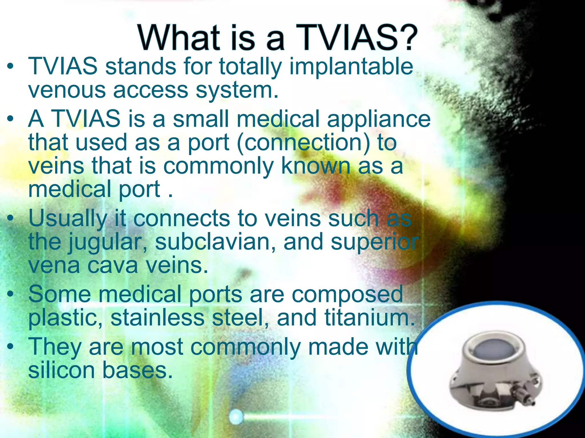 Technical defintion of portacath | PPTX