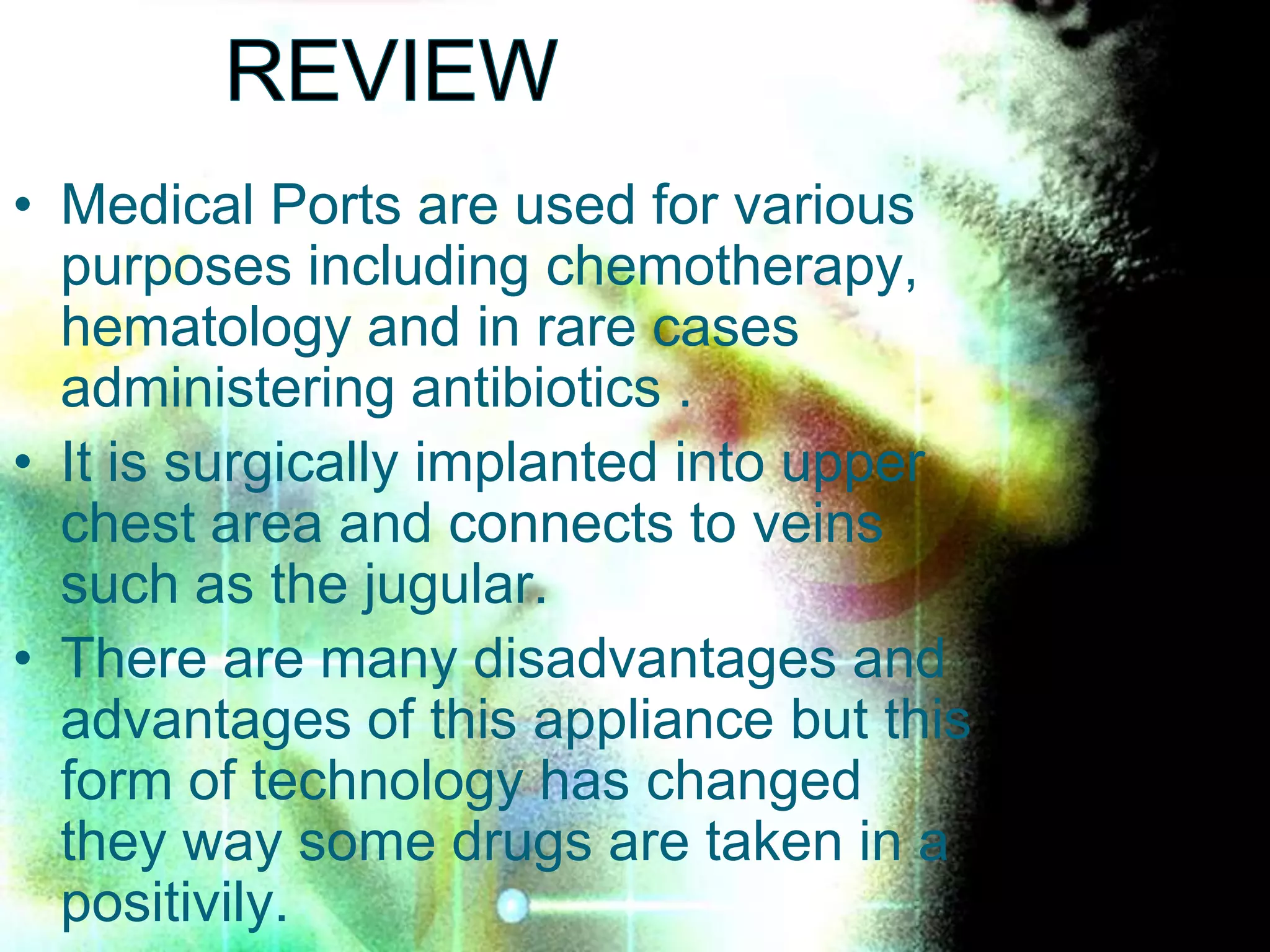 Technical defintion of portacath | PPTX