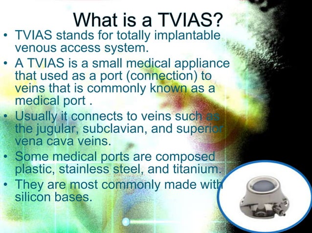 Technical defintion of portacath | PPT