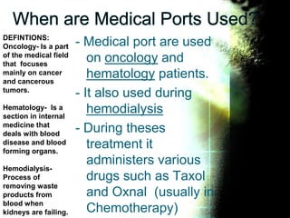 Technical defintion of portacath | PPT