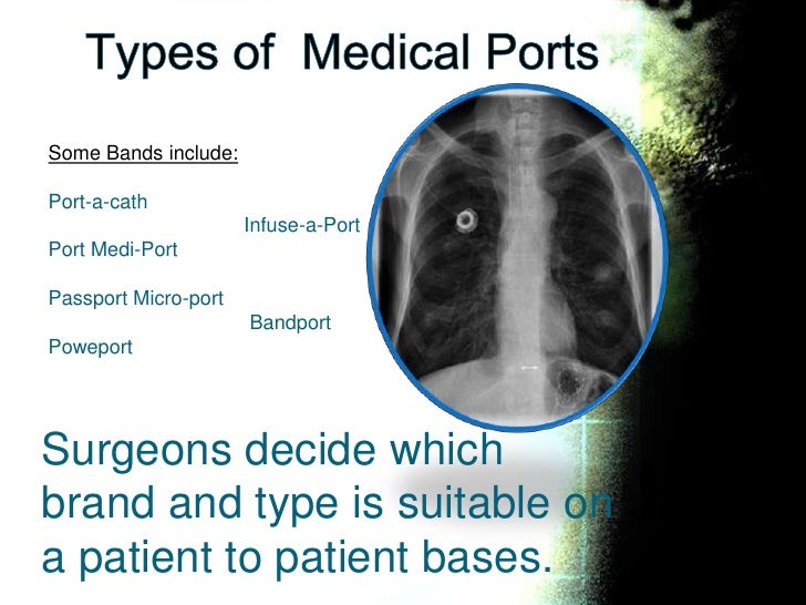 Technical defintion of portacath