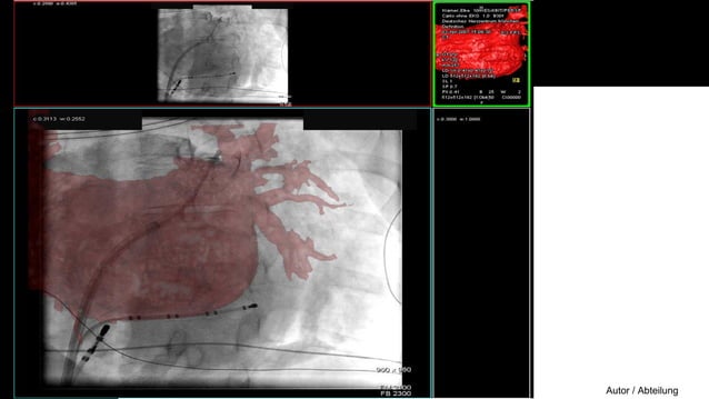 Technical developmpentscardiovascularimaging | PPT