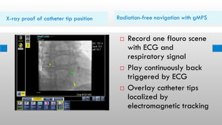 Technical developmpentscardiovascularimaging | PPT