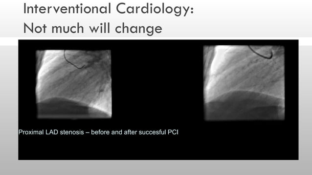 Technical developmpentscardiovascularimaging | PPT