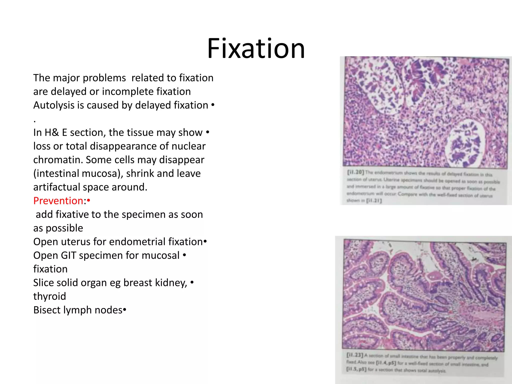 Technical faults in histopathology lab | PPTX