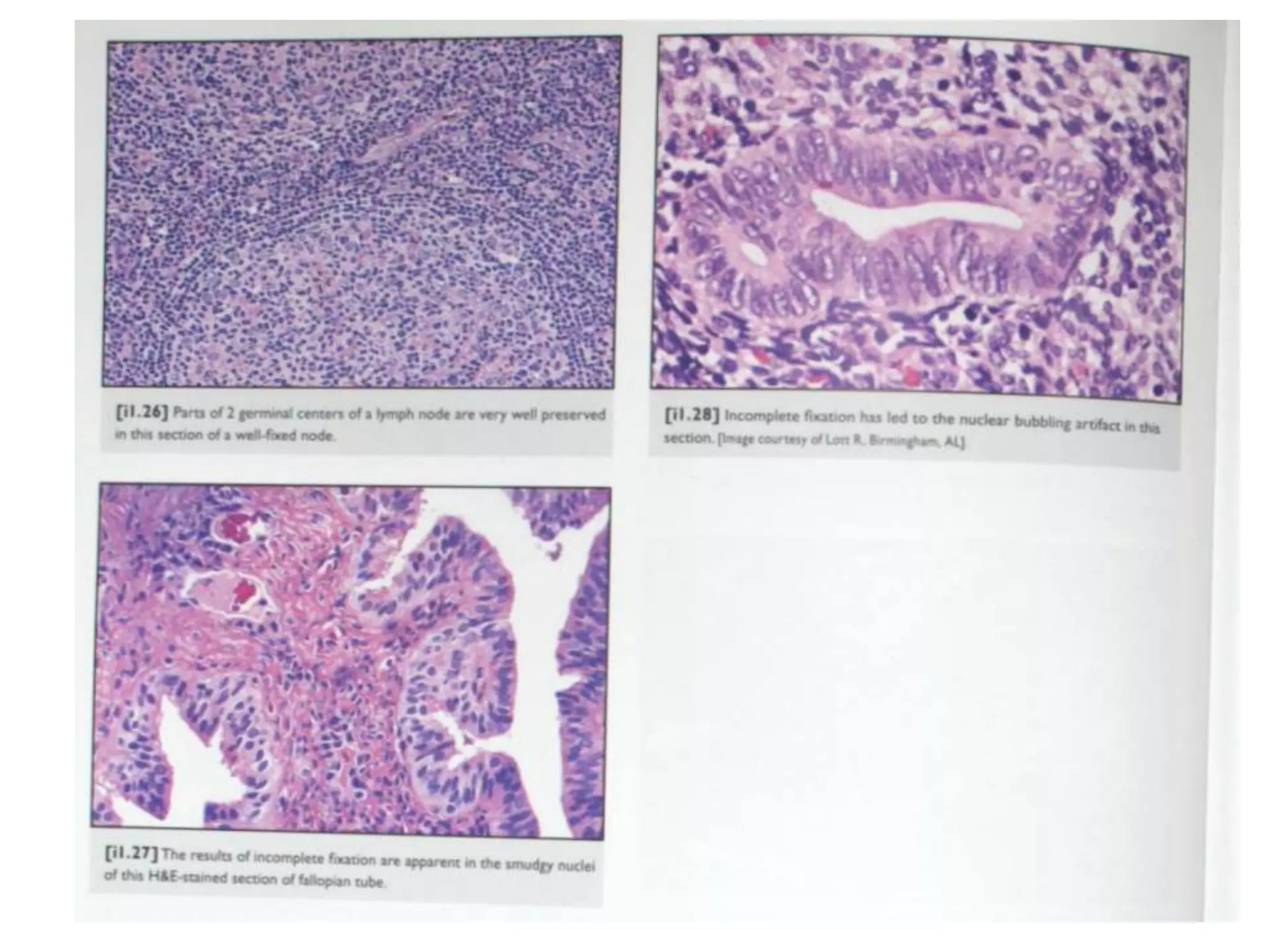 Technical faults in histopathology lab | PPTX