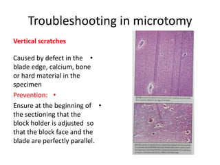 Technical faults in histopathology lab | PPTX