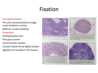 Technical faults in histopathology lab | PPTX