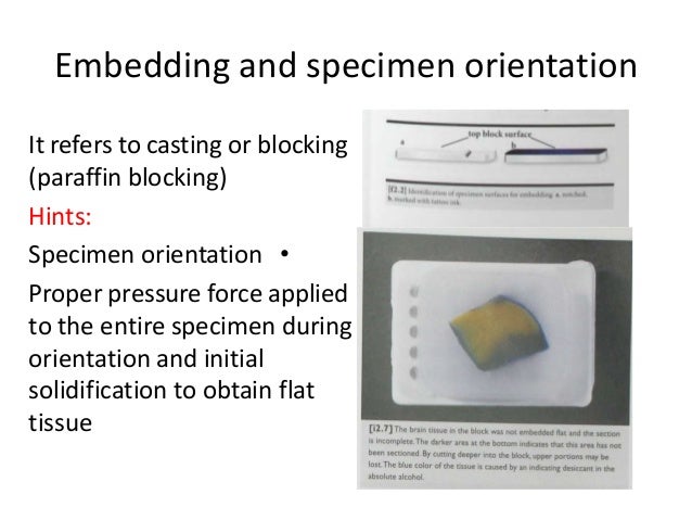 Technical faults in histopathology lab