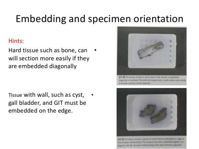 Technical faults in histopathology lab
