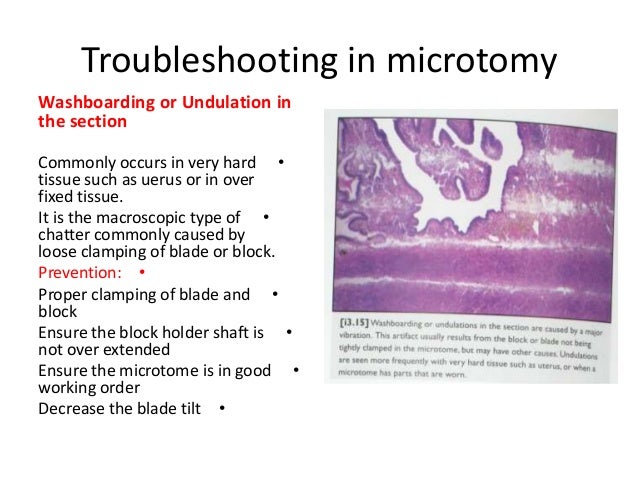 Technical faults in histopathology lab