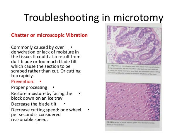 Technical faults in histopathology lab