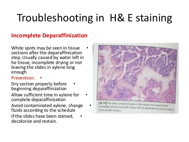 Technical faults in histopathology lab