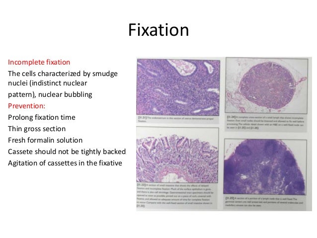 Technical faults in histopathology lab