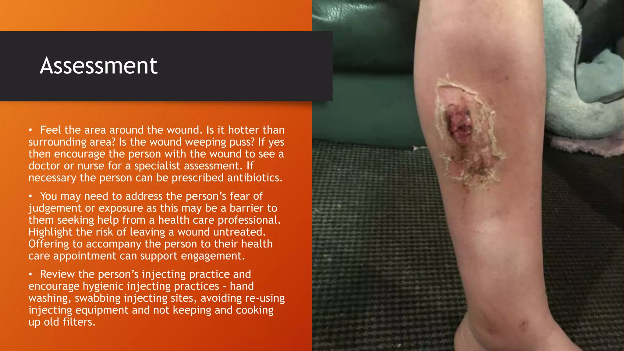 Technical presentation from Coact on wound care management | PPTX ...