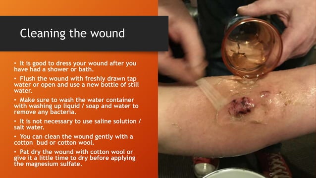 Technical presentation from Coact on wound care management | PPT