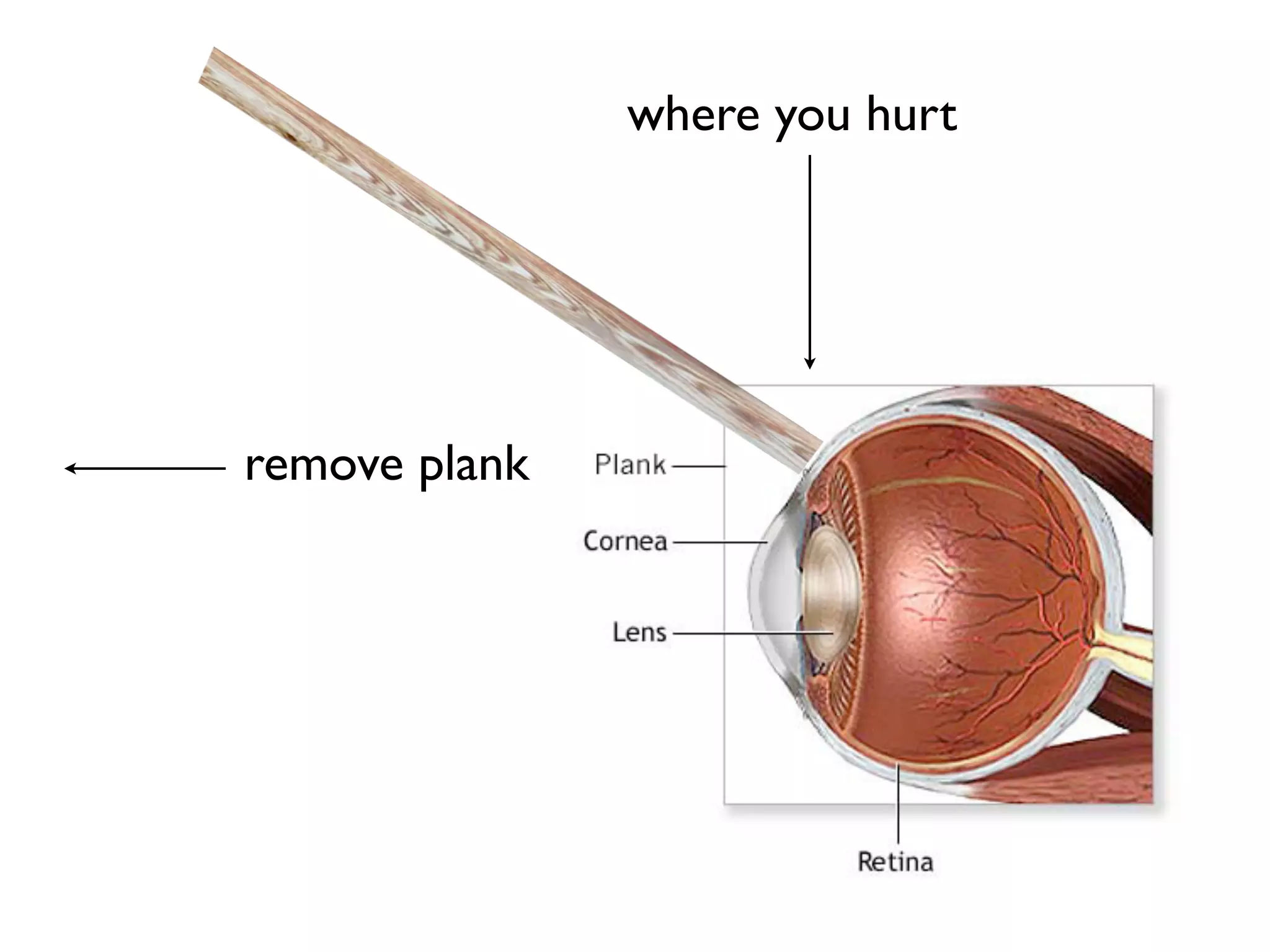 Technique for removing foreign objects from the cornea | PPT Technique for removing foreign objects from the cornea | PPT