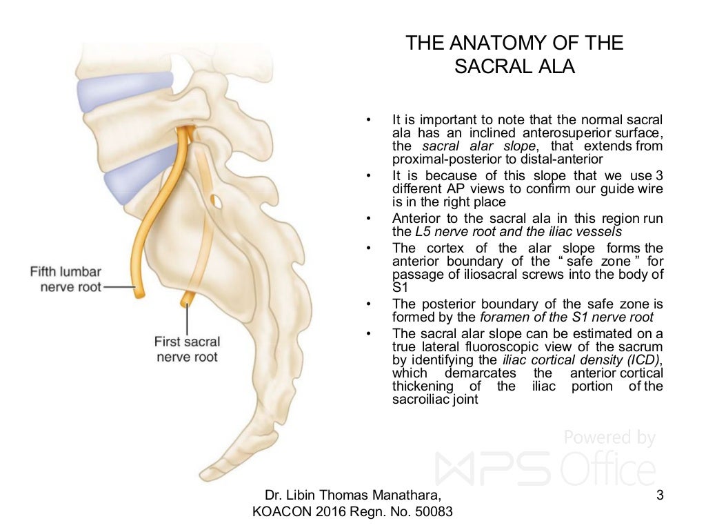Technique Of Percutaneous Iliosacral Screw Fixation Of Sacroiliac Dis…