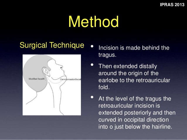 Parotid Salivary Gland Removal Superficial Parotidectomy