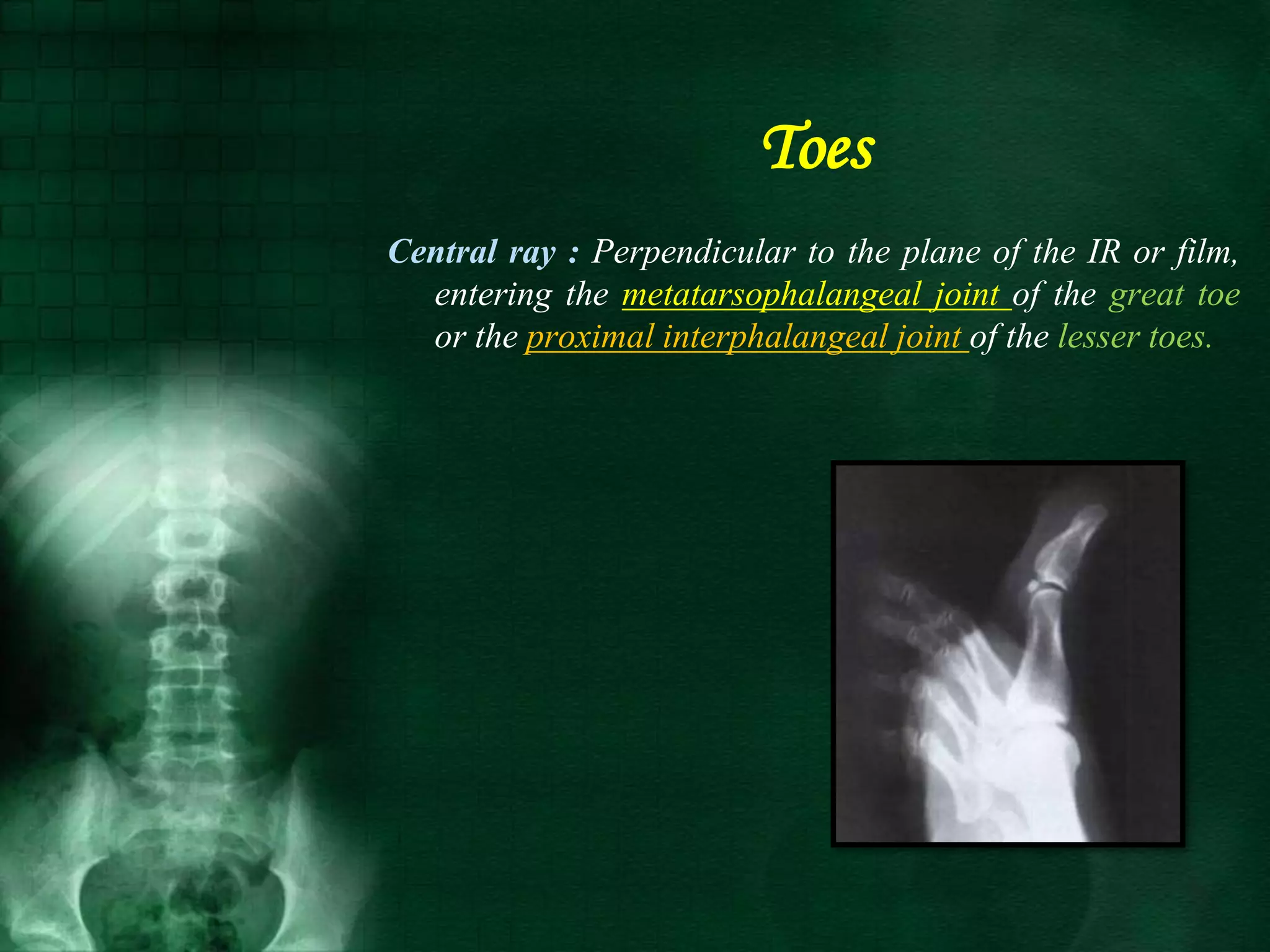 Technique 1 Lower limbs 1 | PPTX