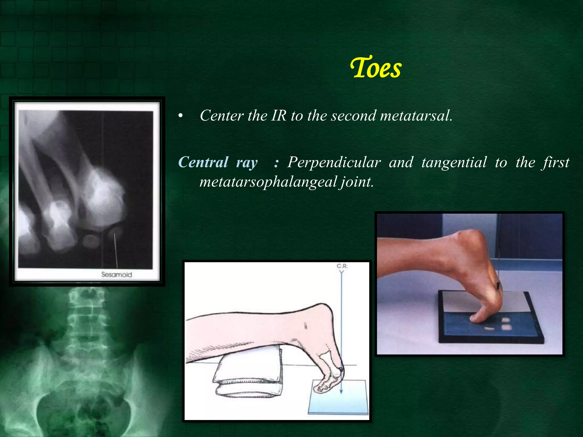 Technique 1 Lower limbs 1 | PPTX