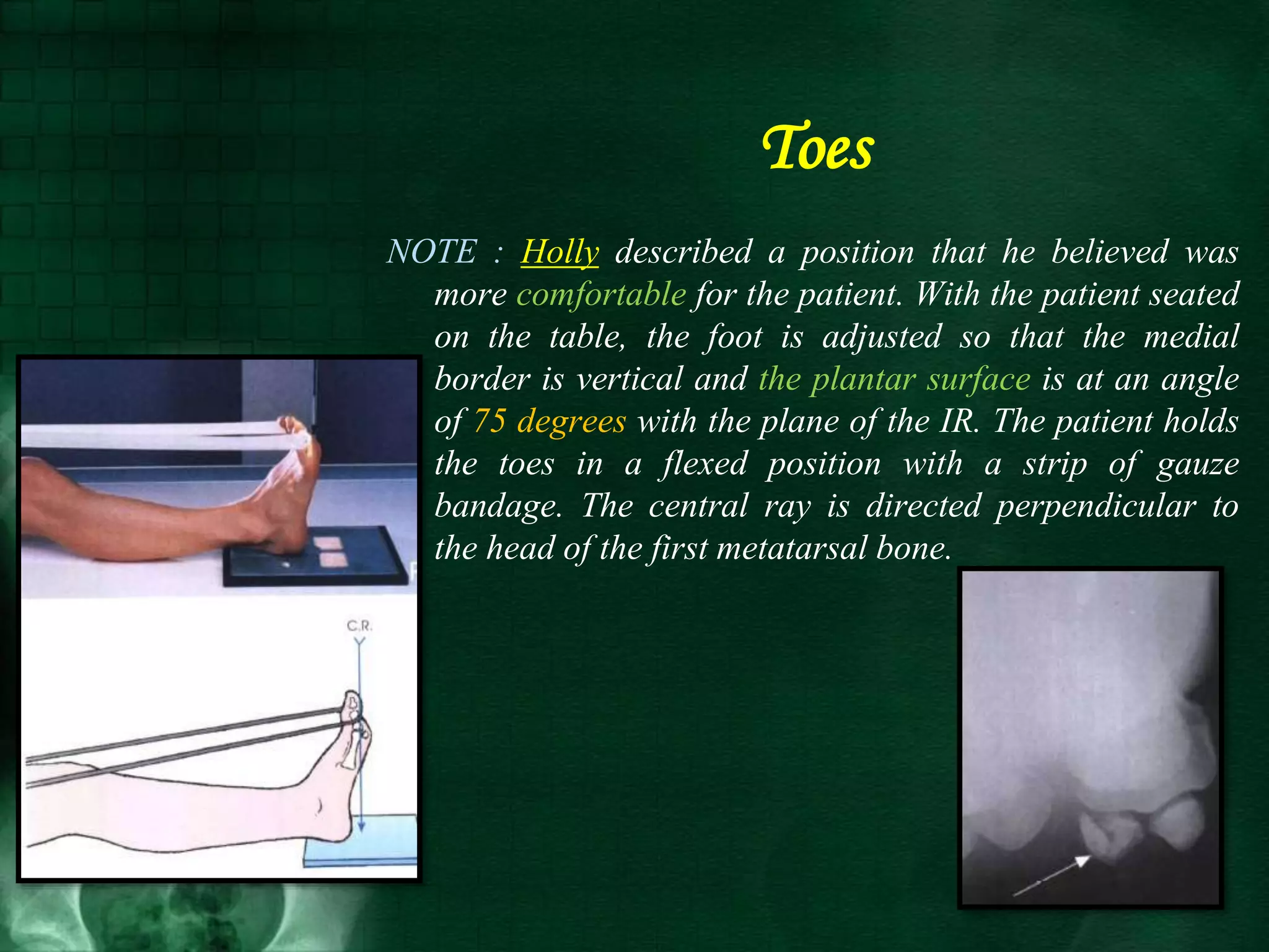 Technique 1 Lower limbs 1 | PPTX