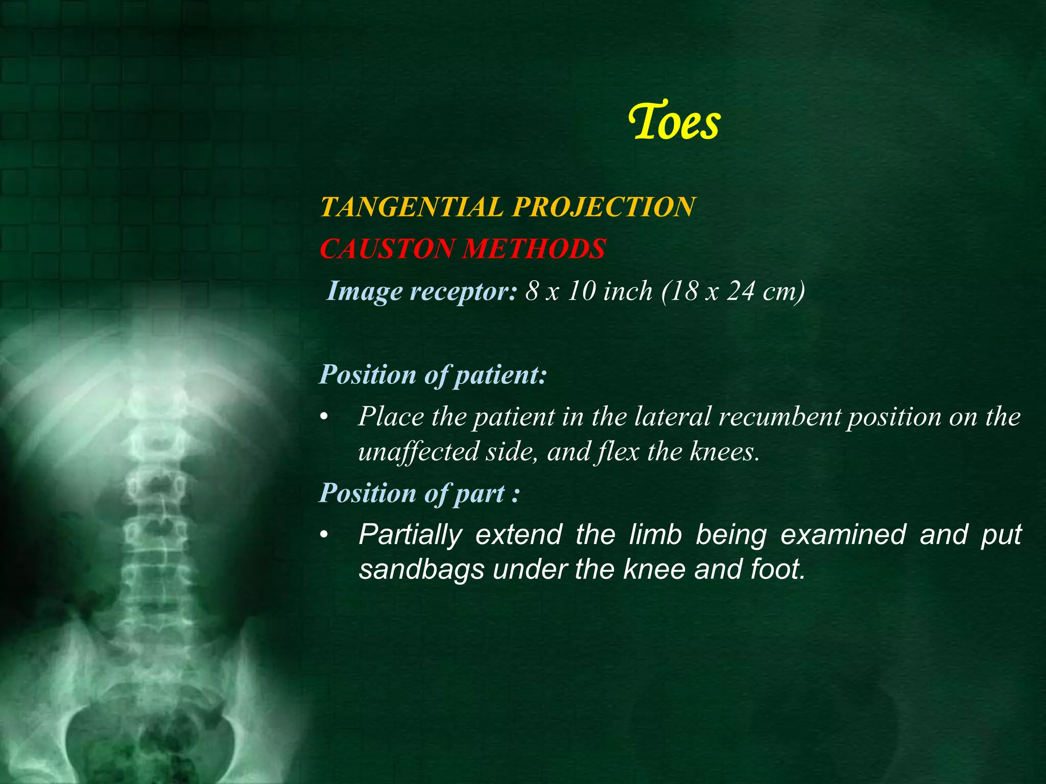 Technique 1 Lower limbs 1 | PPTX