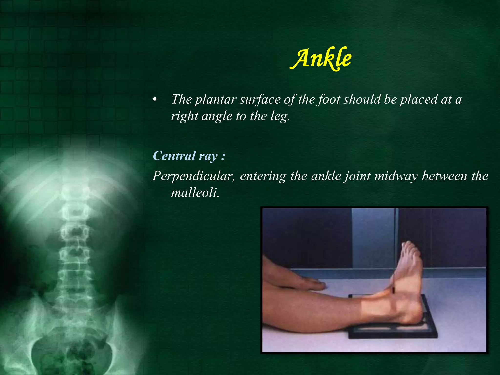 Technique 1 Lower limbs 1 | PPTX