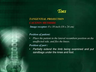 Technique 1 Lower limbs 1 | PPTX