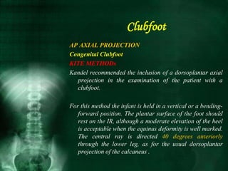 Technique 1 Lower limbs 1 | PPT