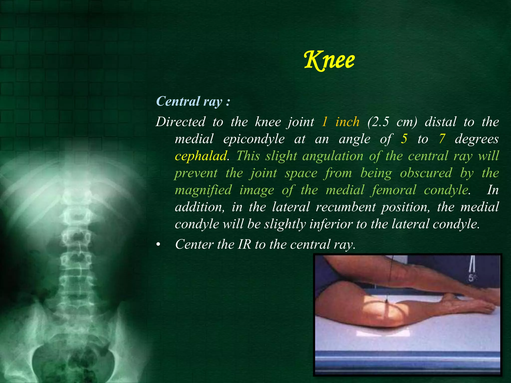 Technique 1 Lower limbs 2 | PPTX