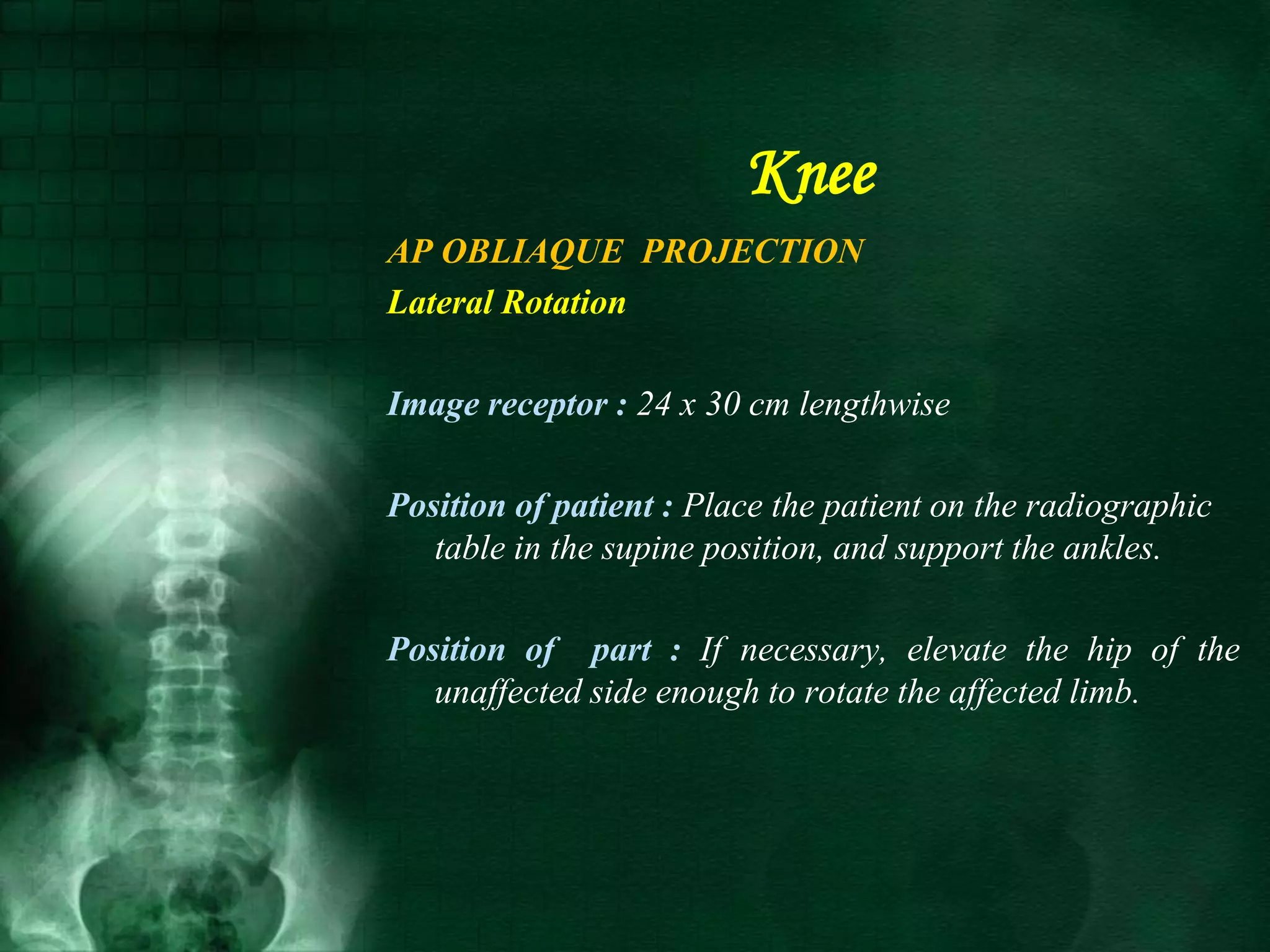 Technique 1 Lower limbs 2 | PPTX