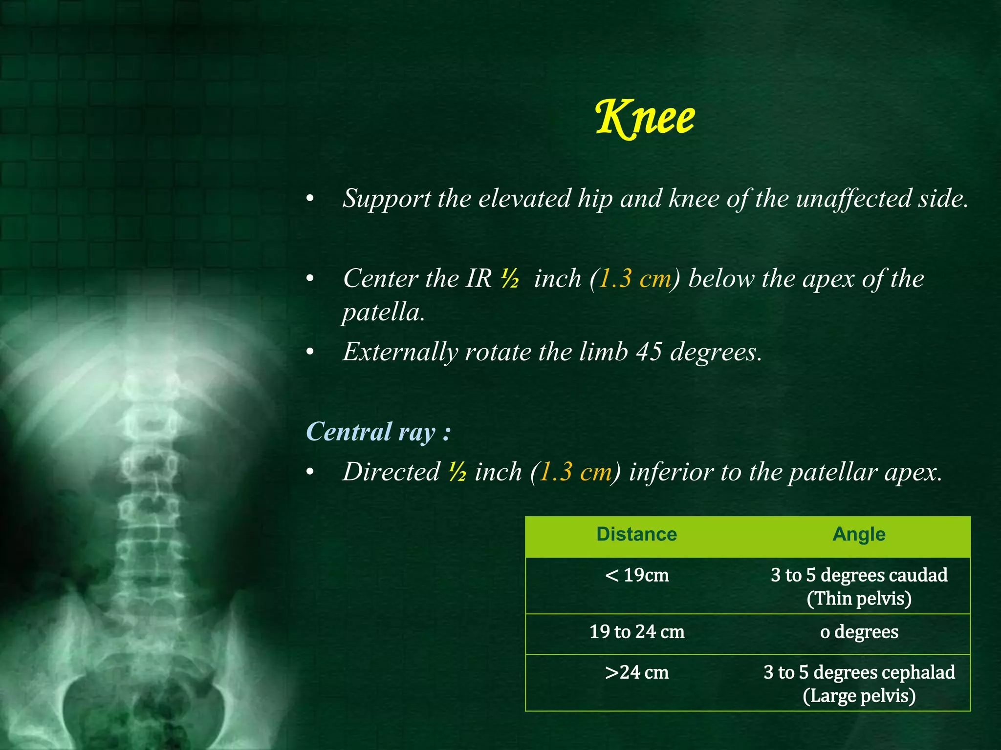 Technique 1 Lower limbs 2 | PPTX