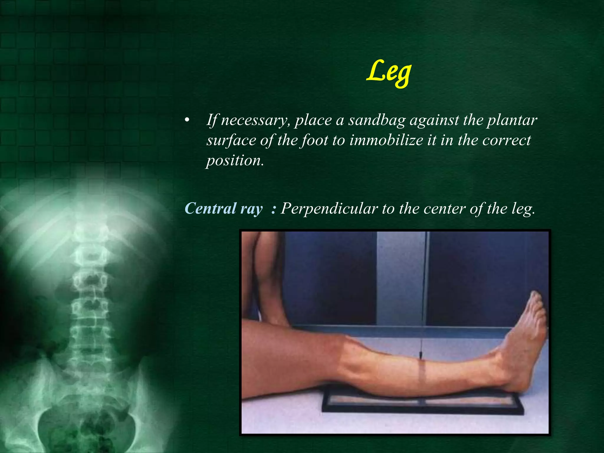 Technique 1 Lower limbs 2 | PPTX