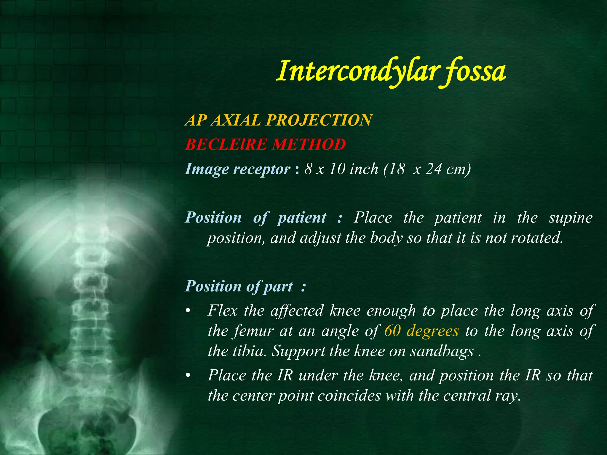 Technique 1 Lower limbs 2 | PPTX