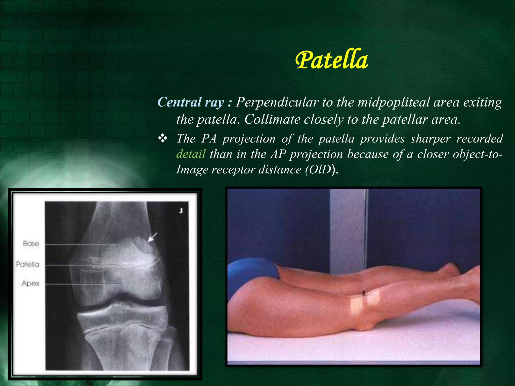 Technique 1 Lower limbs 2 | PPTX