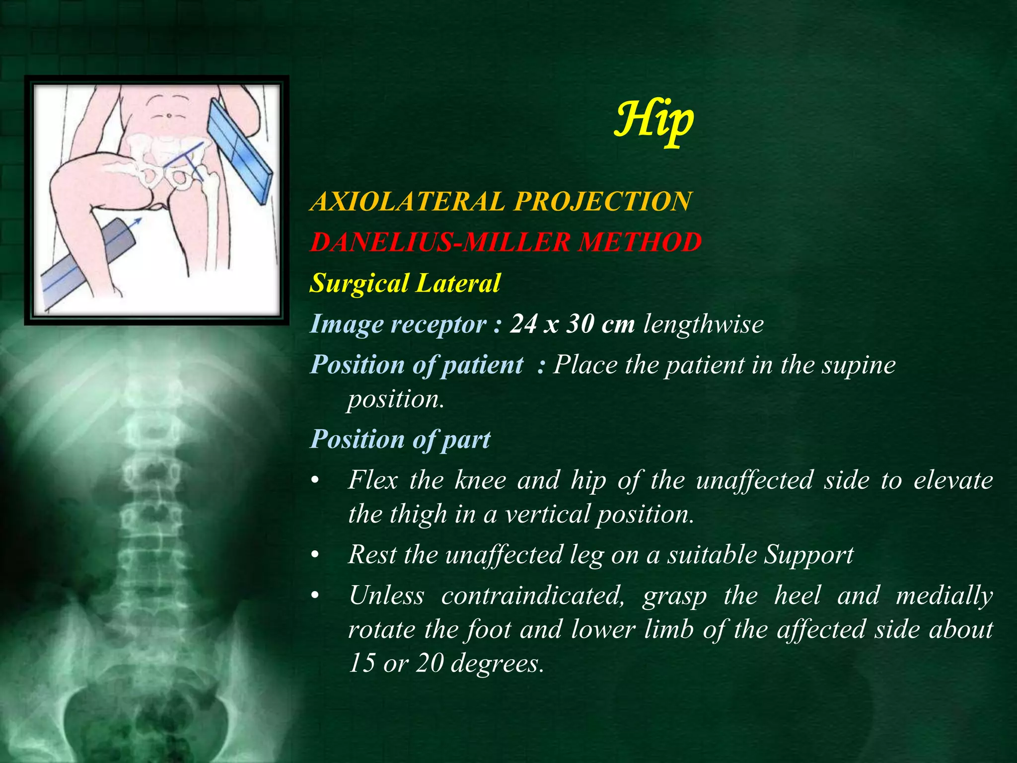 Technique 1 Lower limbs 3 | PPTX