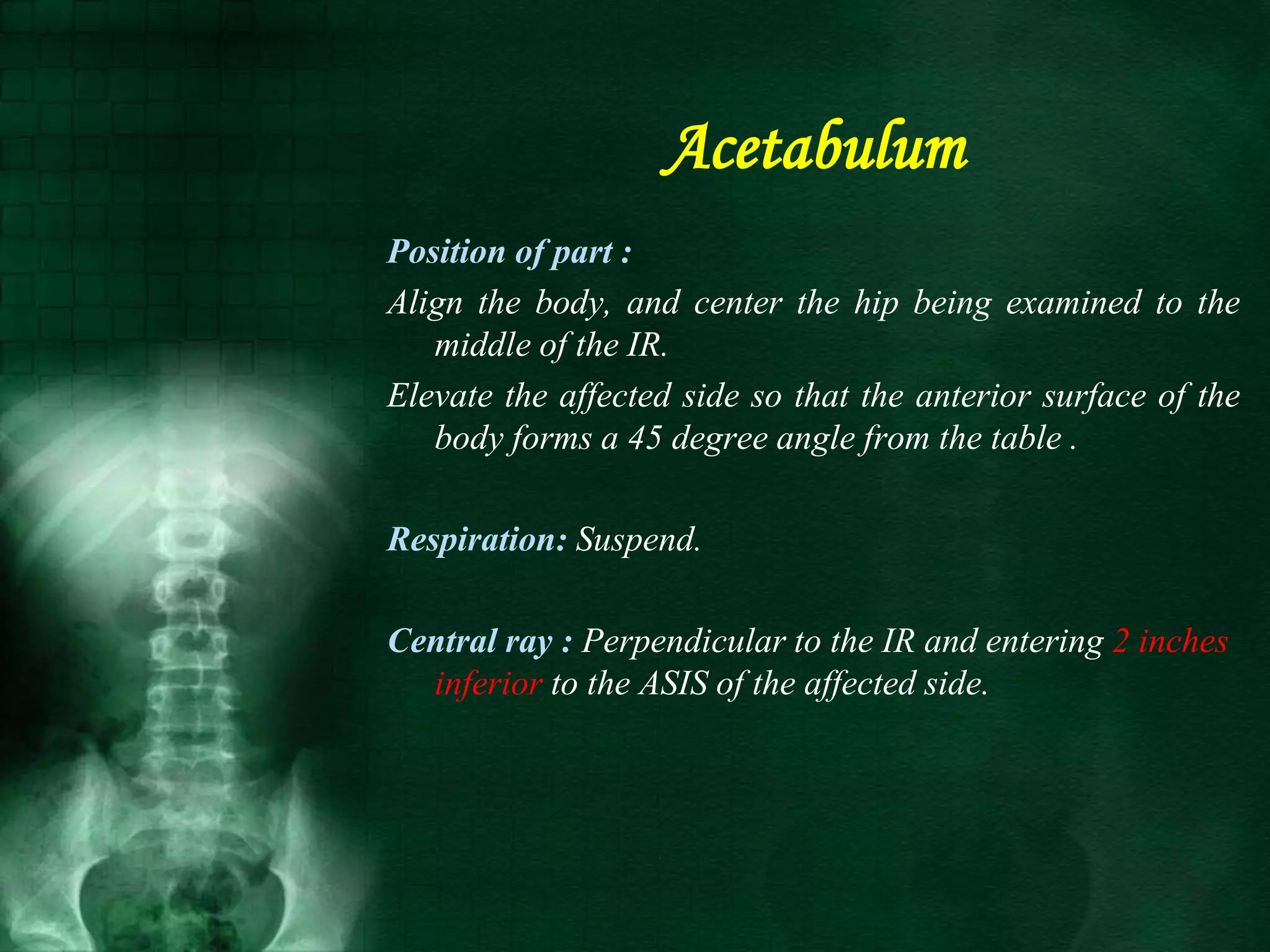 Technique 1 Lower limbs 3 | PPTX