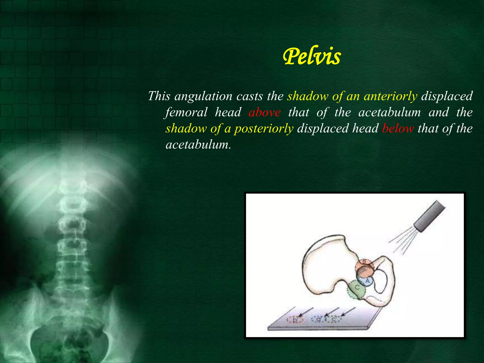Technique 1 Lower limbs 3 | PPT