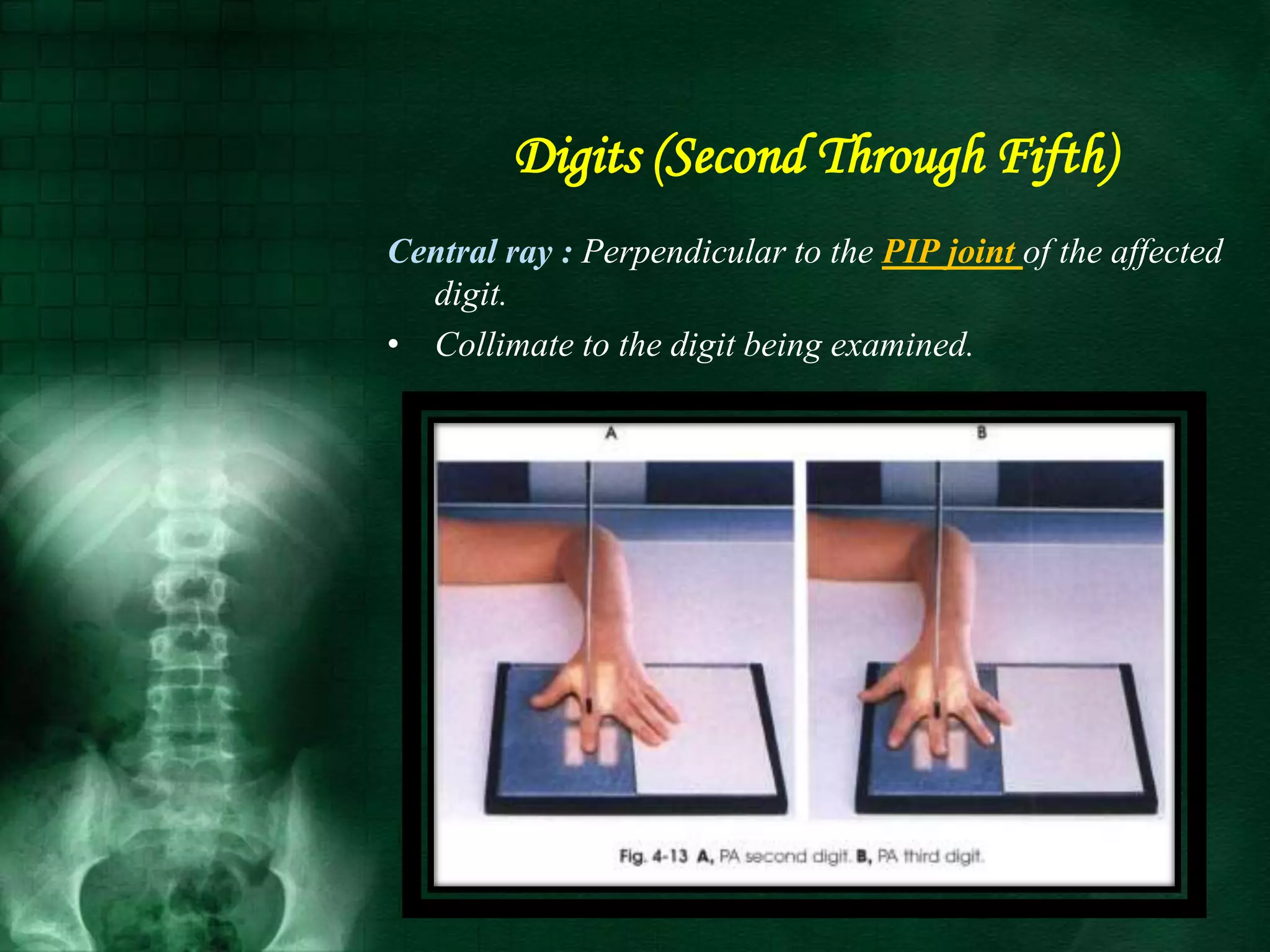 Technique 1 Upper limbs 1 | PPTX