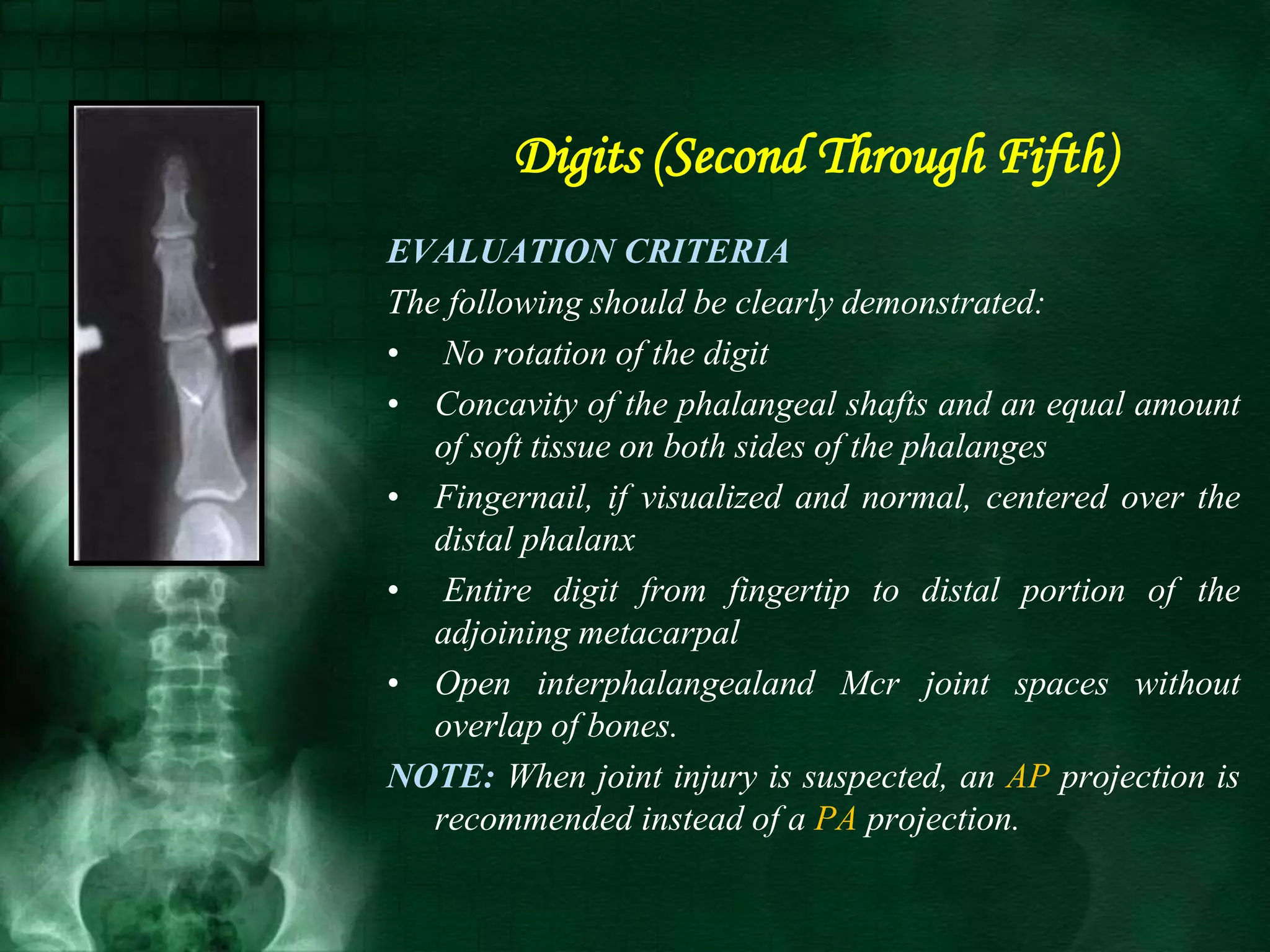 Technique 1 Upper limbs 1 | PPTX