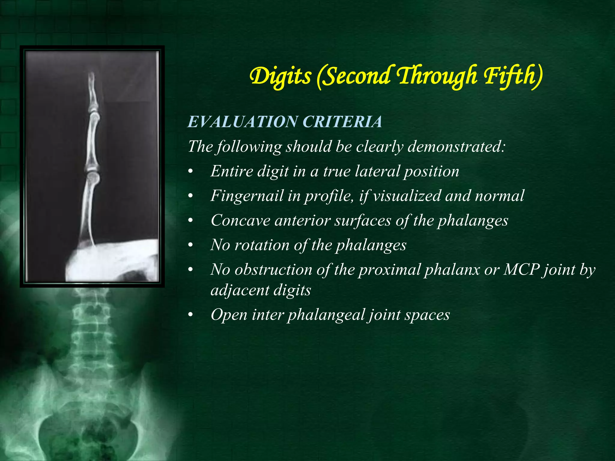 Technique 1 Upper limbs 1 | PPTX