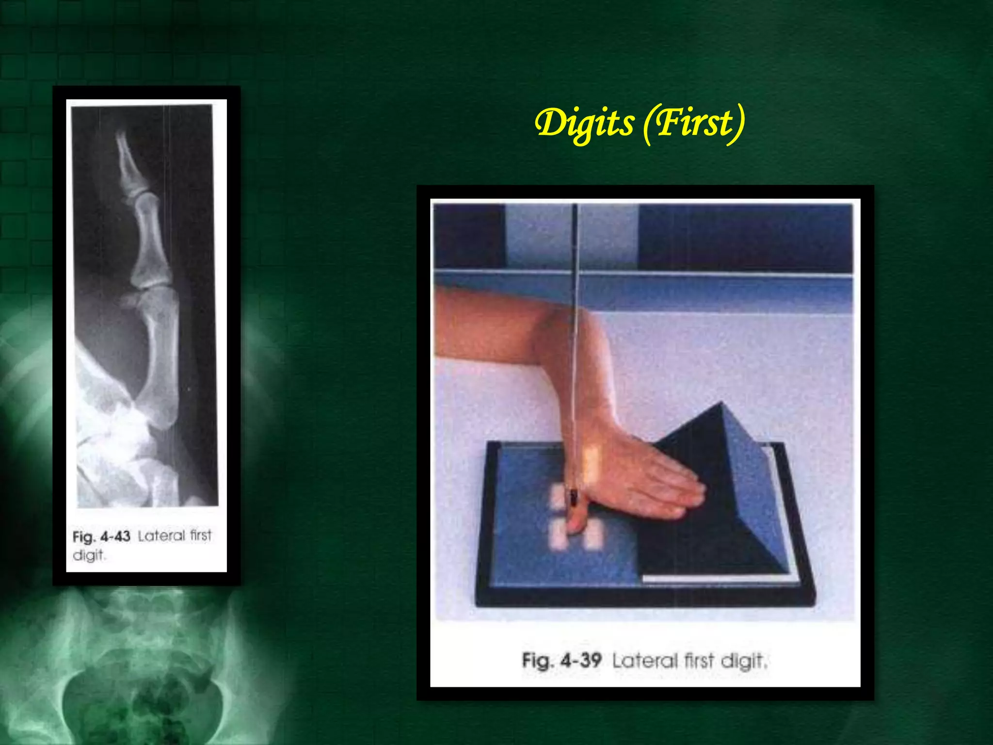 Technique 1 Upper limbs 1 | PPTX