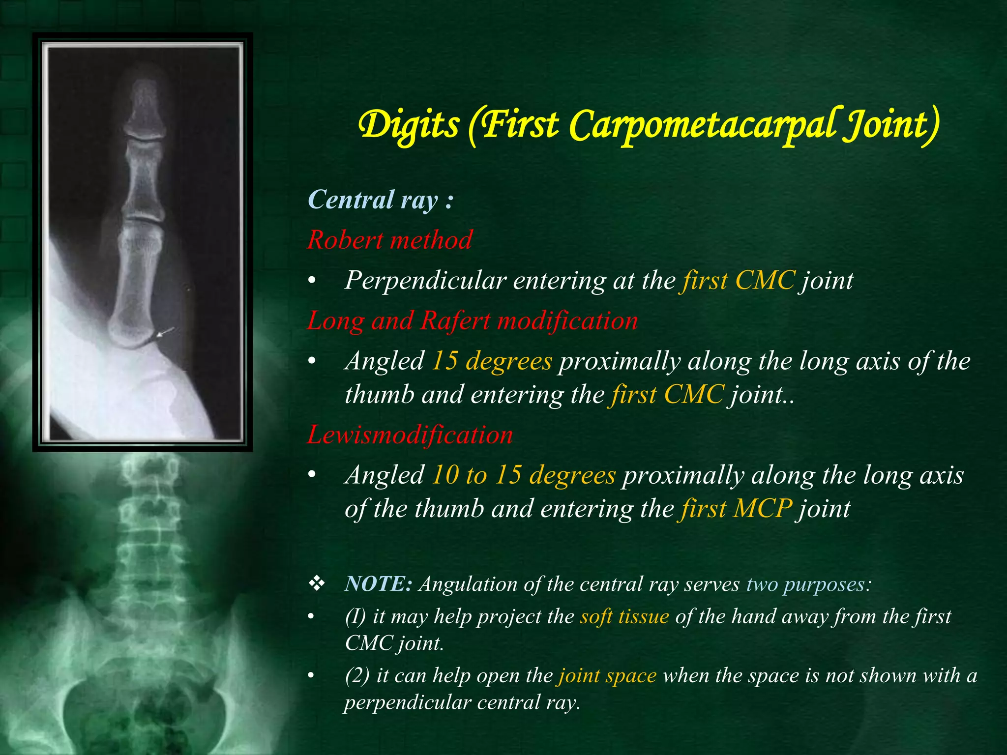 Technique 1 Upper limbs 1 | PPTX