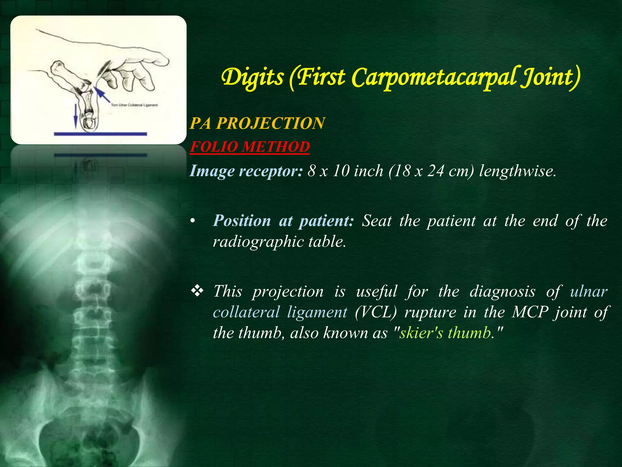 Technique 1 Upper limbs 1 | PPTX